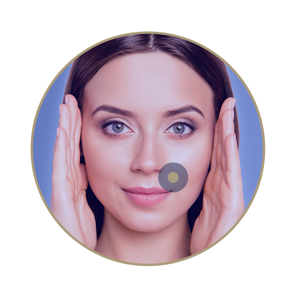 Nasolabial folds - Médecine ésthétique Mulhouse 68